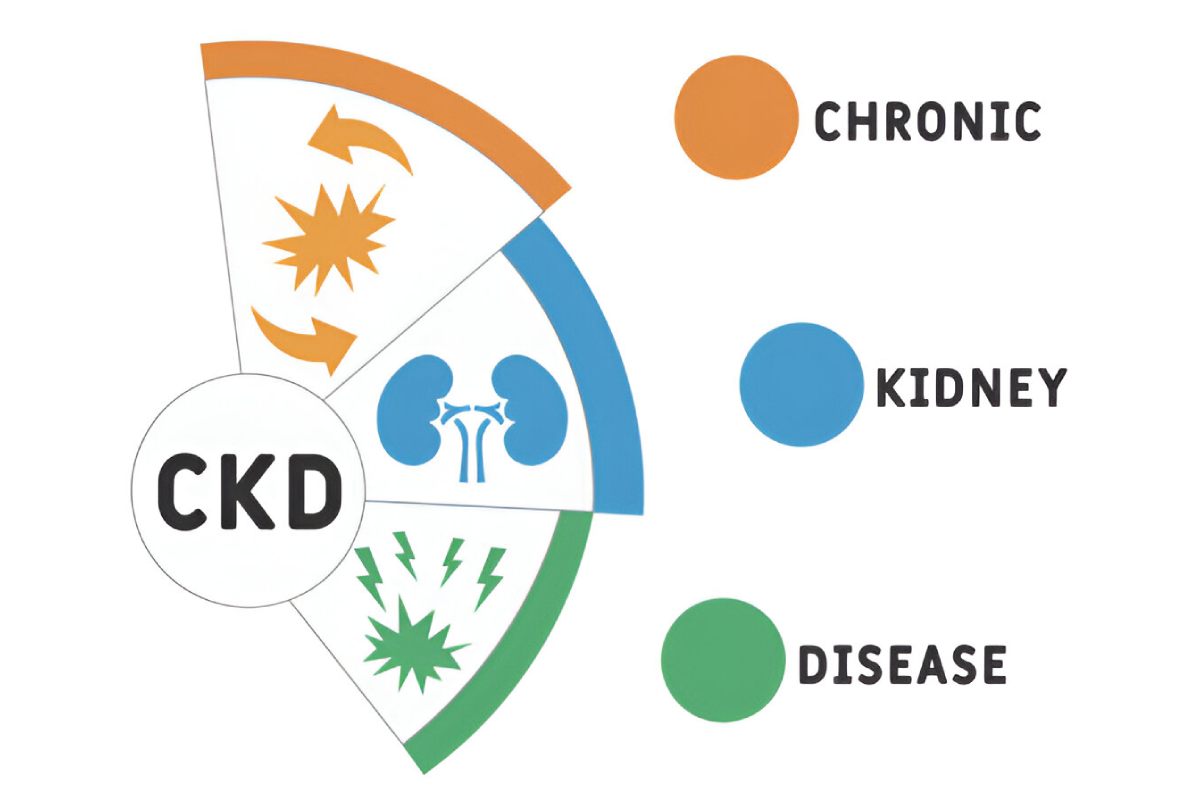 Chronic Kidney Disease – Cause, Symptoms, and More
